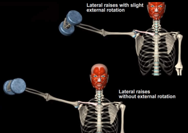Lateral Raise To Build Your Shoulders | Benefits, Variations & Anatomy