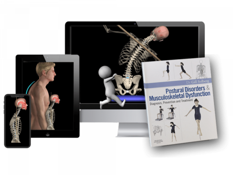 Posture App with 3D Videos | Postural Disorders, Treatment, Tests, Etc.