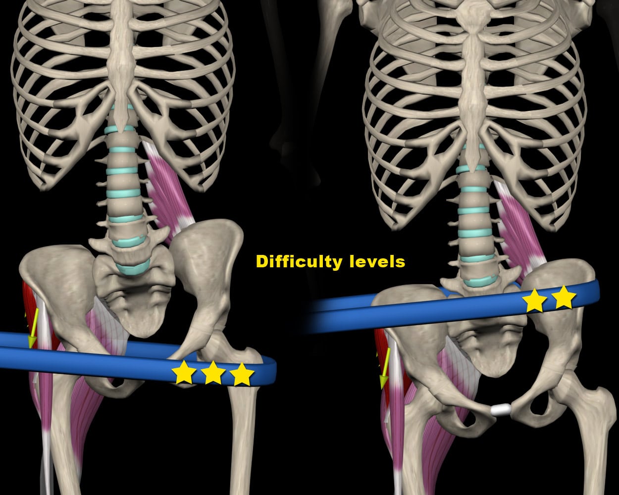 Mastering the Hip Hike Exercise | Muscle and Motion Blog