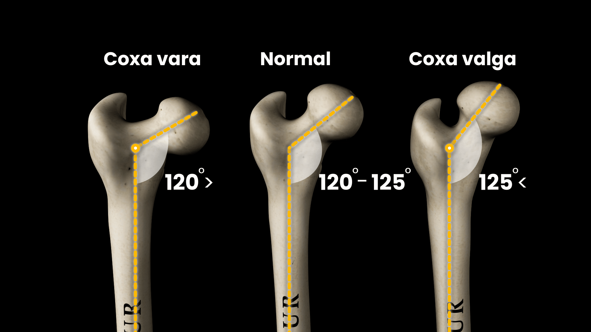 Anatomy of the Hip Joint: Bones, Ligaments, and Muscles | Muscle and Motion official blog